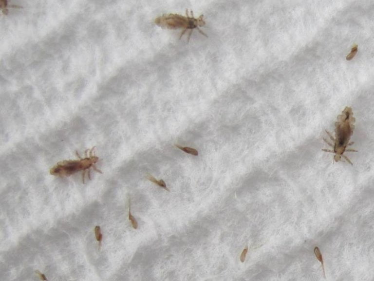 Professional Lice Check Near You | Lice Charmers 100% Effective Lice ...